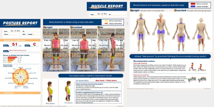 Posture Assessment Software Yugamiru Cloud｜Healthcare IT Solution